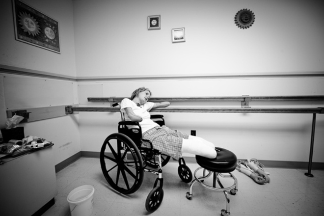 Quadruple Amputee Lindsay Ess - Amputee Devotee