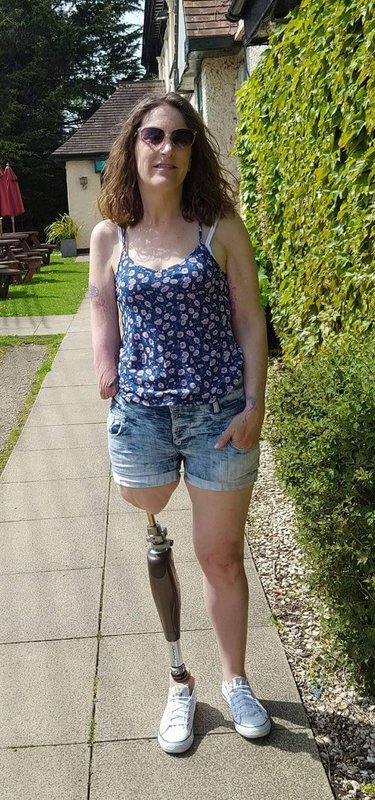 Amputee end prosthesis - Page 2 - Amputee Devotee