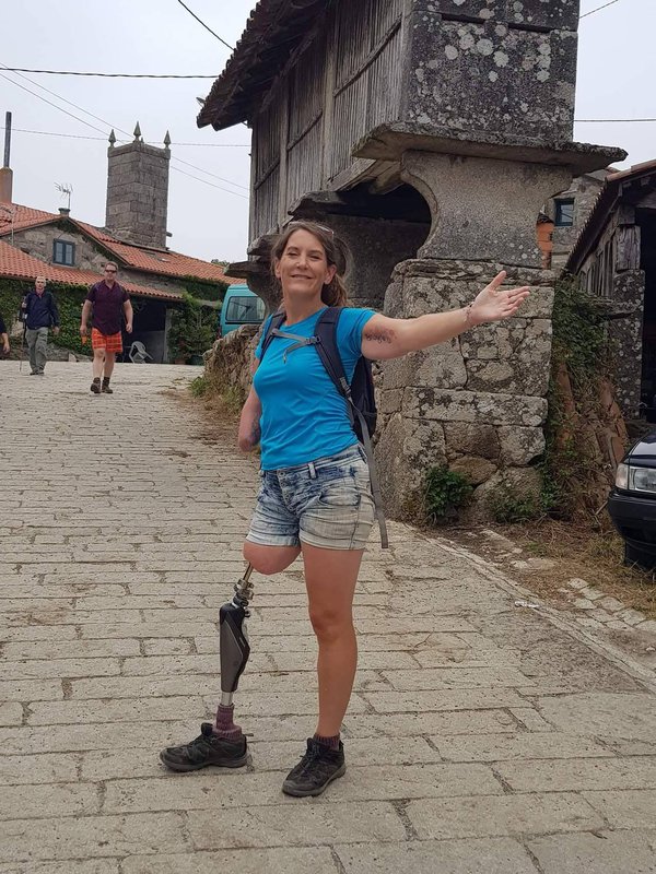 Amputee end prosthesis - Page 2 - Amputee Devotee