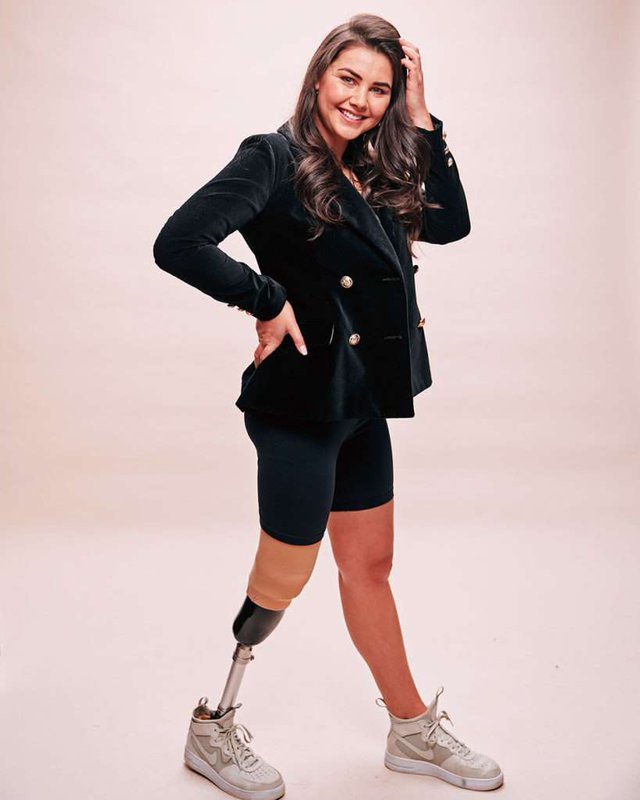 Amputee model Jess Quinn - Amputee Devotee