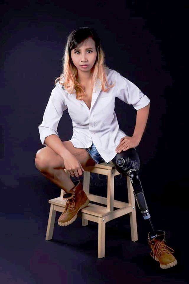 Prosthetic leg - Page 2 - Amputee Devotee