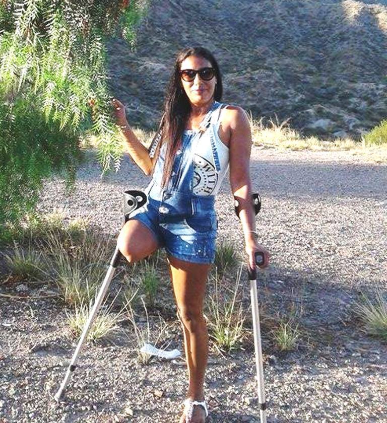 Изображение было размещено пользователем ресурса: "Amputee Devotee ...